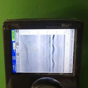 Le Ferroscan, tout ce qu'il faut savoir